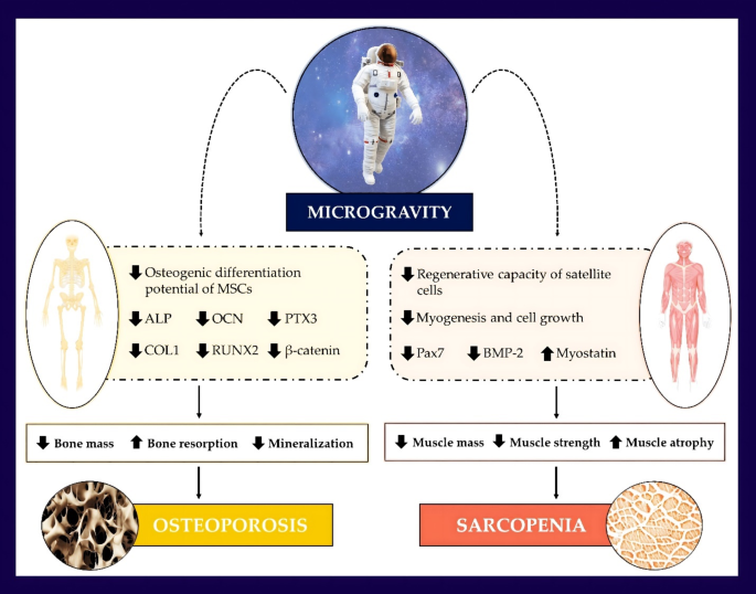 Exploring the Frontier of Space Medicine: The Nexus of Bone ...
