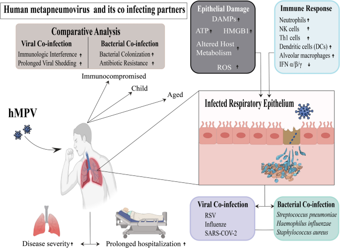 hMPV co-infections: Distinct immunopathogenic mechanisms and clinical ...