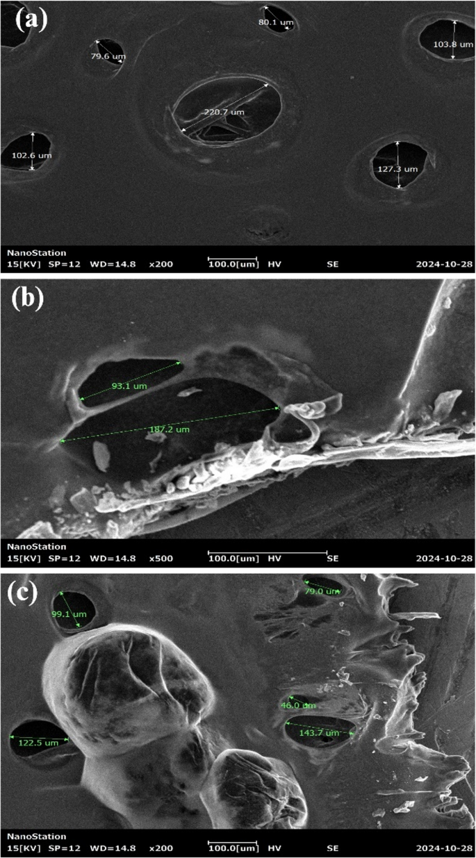 Development of Sertaconazole Loaded Nanoemulgel Using Quality by Design ...