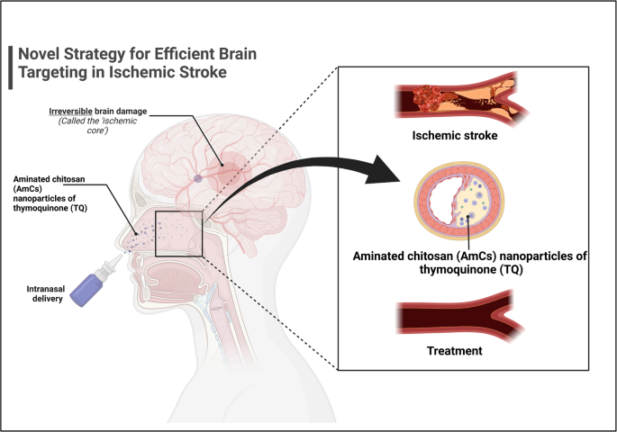 Nanoparticle-Enhanced Intranasal Drug Delivery: A Novel Strategy for ...