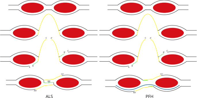 Non-aligned Sutures Increase the Mechanical Strength of Peritoneal Flap ...