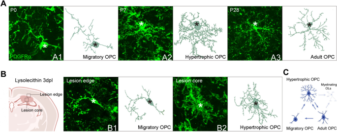 A New Acquaintance of Oligodendrocyte Precursor Cells in the Central ...
