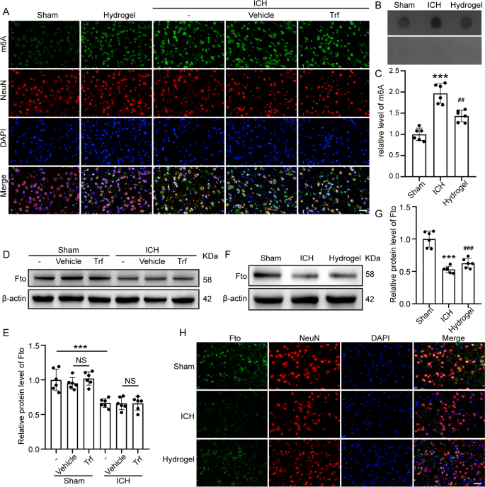 Fto-dependent Vdac3 m6A Modification Regulates Neuronal Ferroptosis ...
