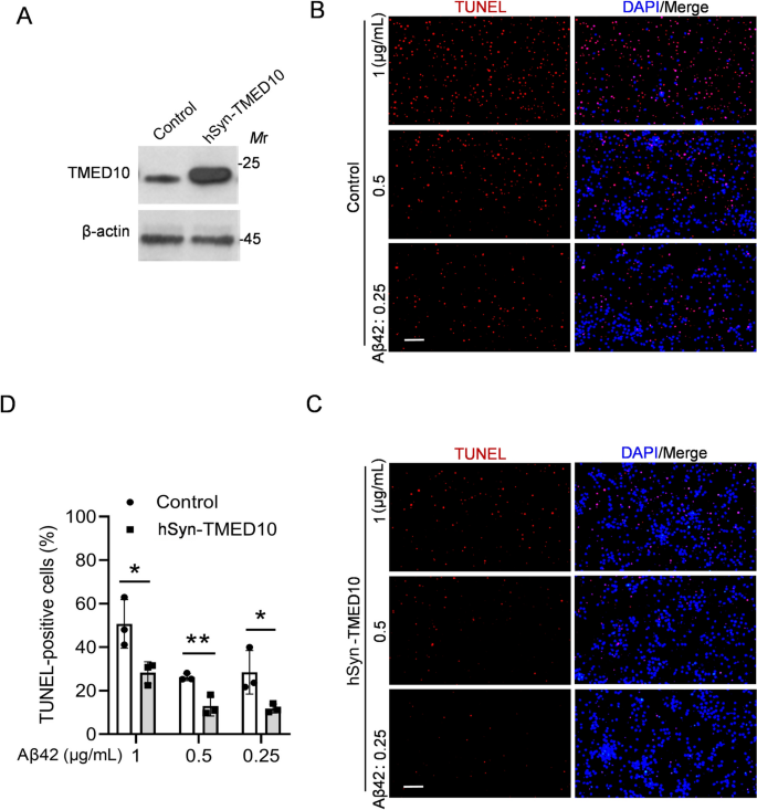 Identification of TMED10 as A Regulator for Neuronal Exocytosis of ...