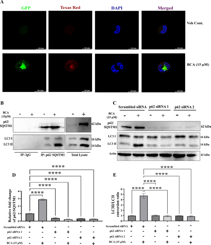 p62/SQSTM1 signaling nexus and orchestration of ERK and mTOR pathways ...