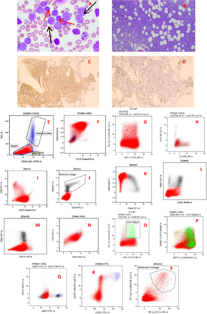 Unusual Blast Phase Transformations in Chronic Myeloid Leukemia: A Case ...