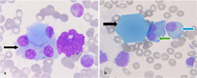 Shapeshifting crystals: Cyan-coloured hexagons in aspirate and ...