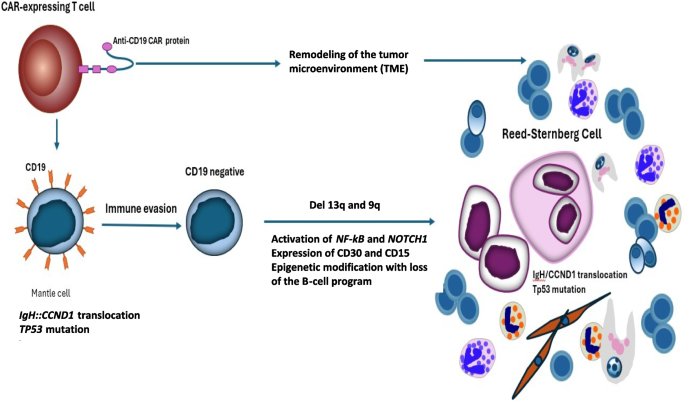 Mantle cell lymphoma transformation to CD19-negative classic Hodgkin ...