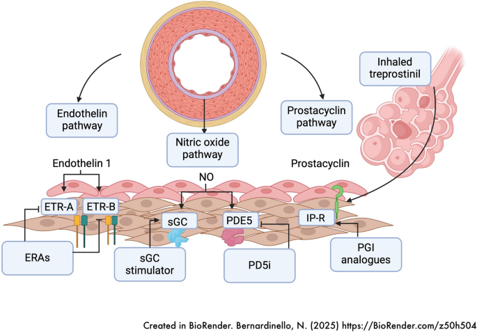 Pulmonary Hypertension Associated with Interstitial Lung Disease (PH ...