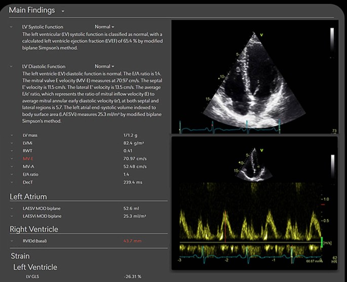 Transforming echocardiography with artificial intelligence ...