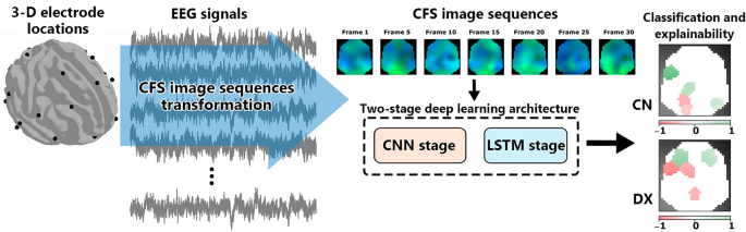 Unraveling Brain Synchronisation Dynamics by Explainable Neural Networks using EEG Signals ...