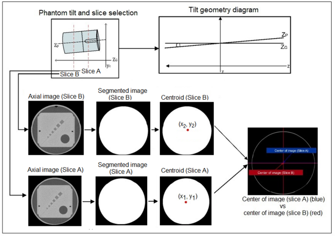 Correction of gantry tilt measurement using phantom tilt on axial CT ...