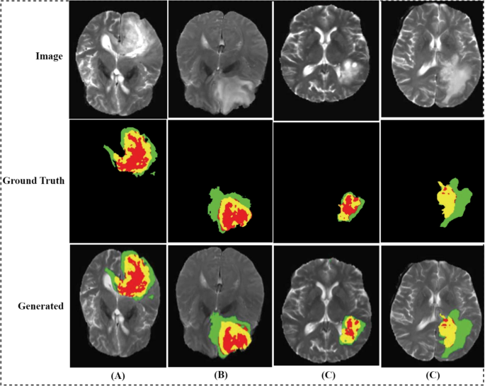 Optimized U-Net Architecture with Enhanced Chimp Optimization Algorithm ...