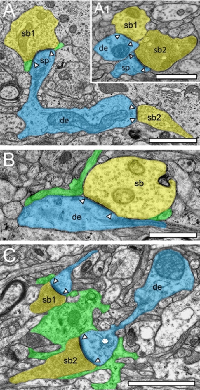 The synaptic organization of the human temporal lobe neocortex by high ...