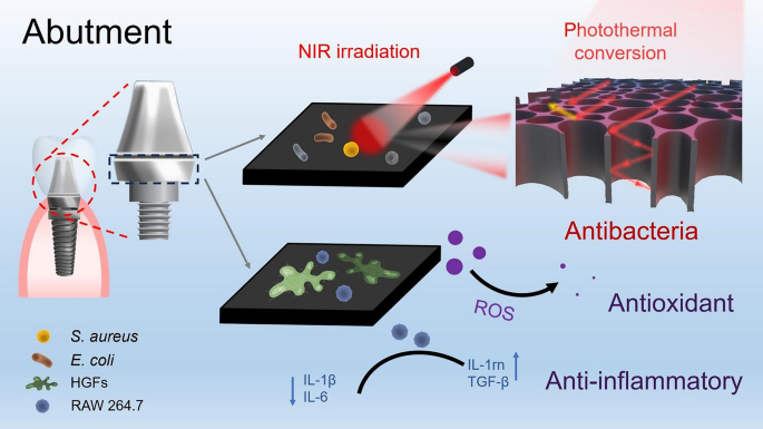 Ce-doped defective titanium oxide coating with antibacterial ...