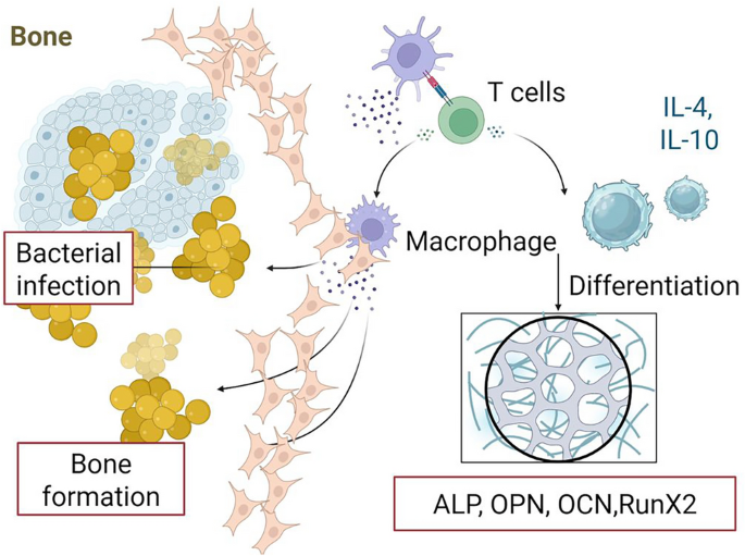 FeS/CeO2/Curcumin heterojunction for infectious arthritis therapy ...