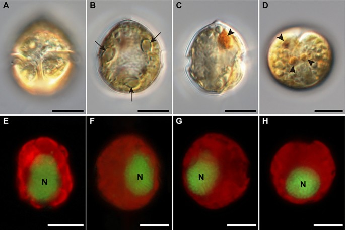 First Report of Scrippsiella irregularis Attaran-Fariman & Bolch ...