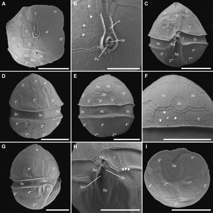 First Report of Scrippsiella irregularis Attaran-Fariman & Bolch ...