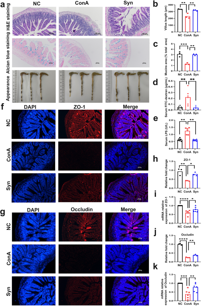 Gut Microbiota Dysbiosis and LPS/NLRP3/GSDMD Pyroptosis Drive Hepatic ...