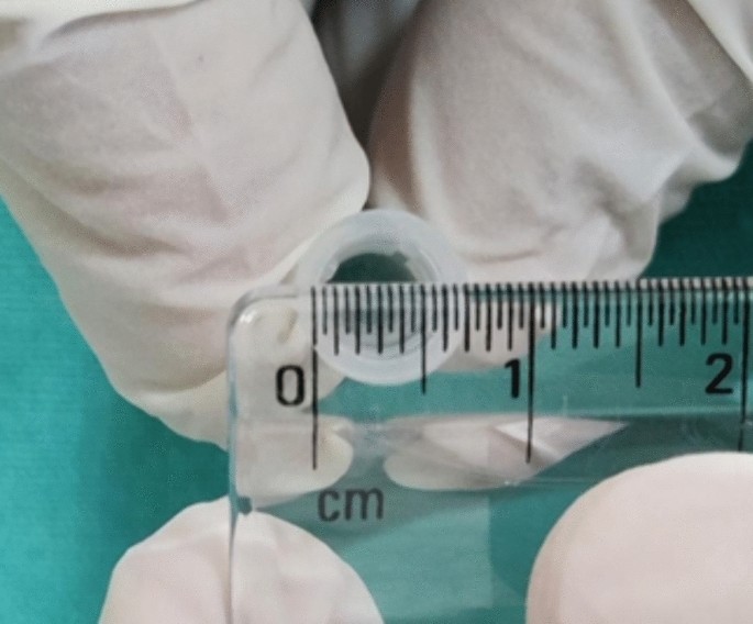 Needle Cap as Suction Cannula: An Expedient Remedy: A Technical Note ...
