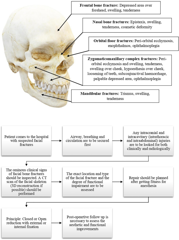 Presentation and Management of Facial Fractures: An Experience from a ...
