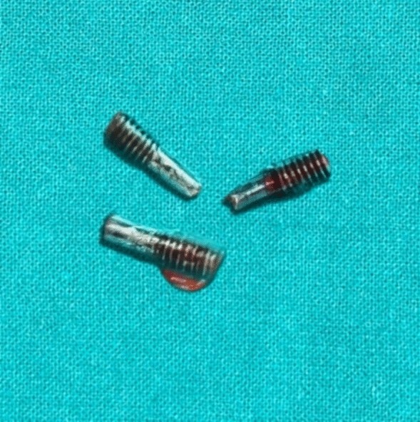 Sadhwani Technique: A Simple and Innovative Method for Retrieving ...