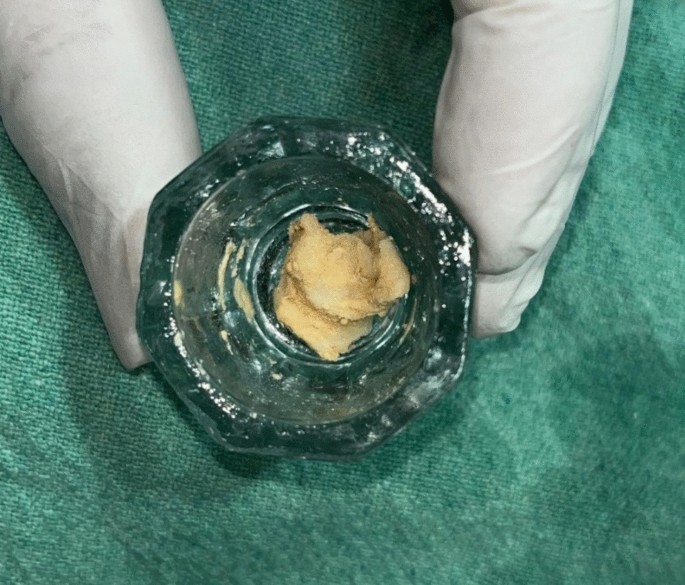 Simvastatin Outperforms Melatonin in Early Alveolar Bone Regeneration ...