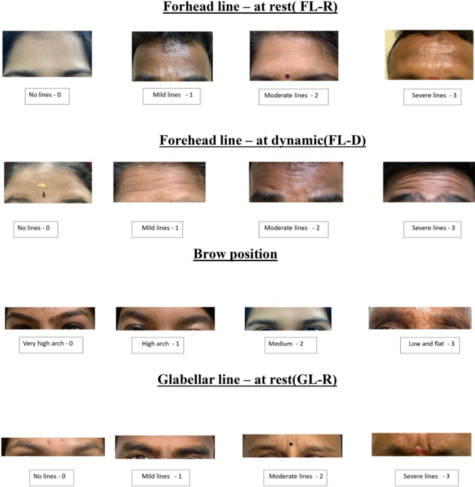 Age Estimation with Facial Changes: Validation of Photo-Numerical Scale ...
