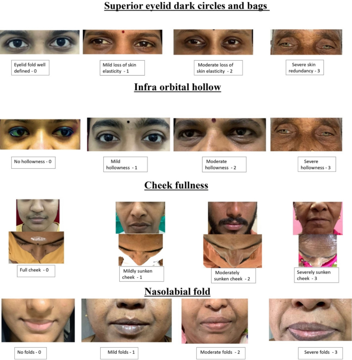 Age Estimation with Facial Changes: Validation of Photo-Numerical Scale ...