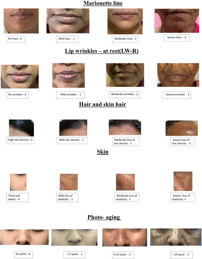 Age Estimation with Facial Changes: Validation of Photo-Numerical Scale ...