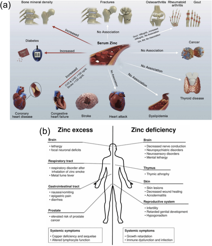 Biodegradable Zinc-Based Alloys for Biomedical Implant Applications: A ...
