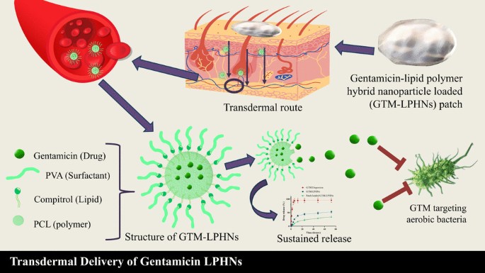 Optimization and Evaluation of Compritol-Based Lipid-Polymer Hybrid ...