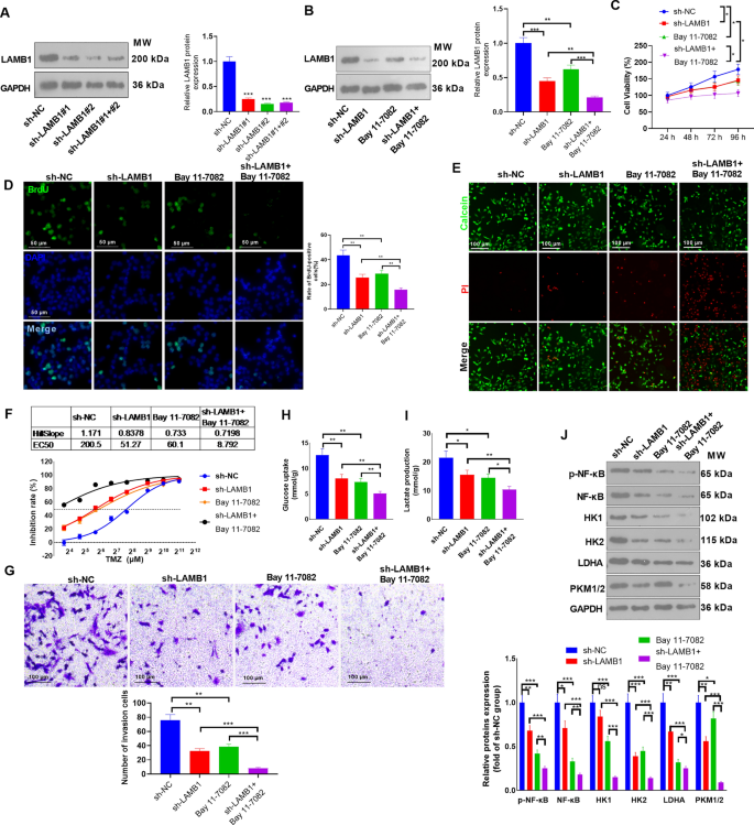 LAMB1 downregulation suppresses glioma progression by inhibiting aerobic glycolysis through ...