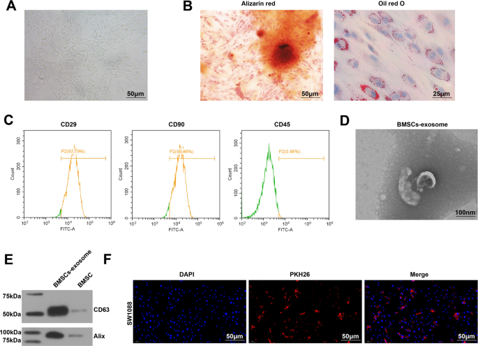 Bone marrow mesenchymal stem cells-derived exosomes deliver microRNA ...