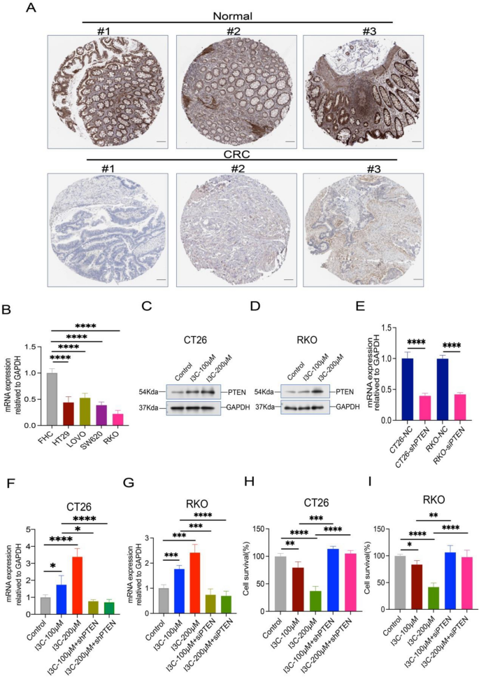 Indole-3-carbinol prevented tumor progression and potentiated PD1ab ...