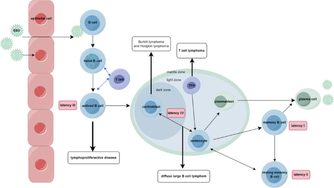 Epstein-Barr virus: biology, pathogenesis and therapy of lymphomas ...