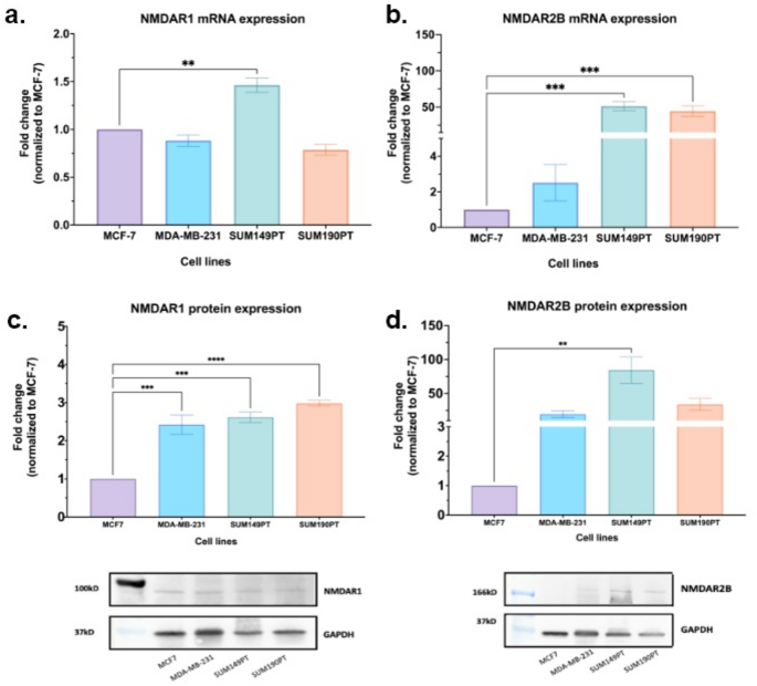 Pharmacological inhibition of NMDA receptors reduces migration and ...