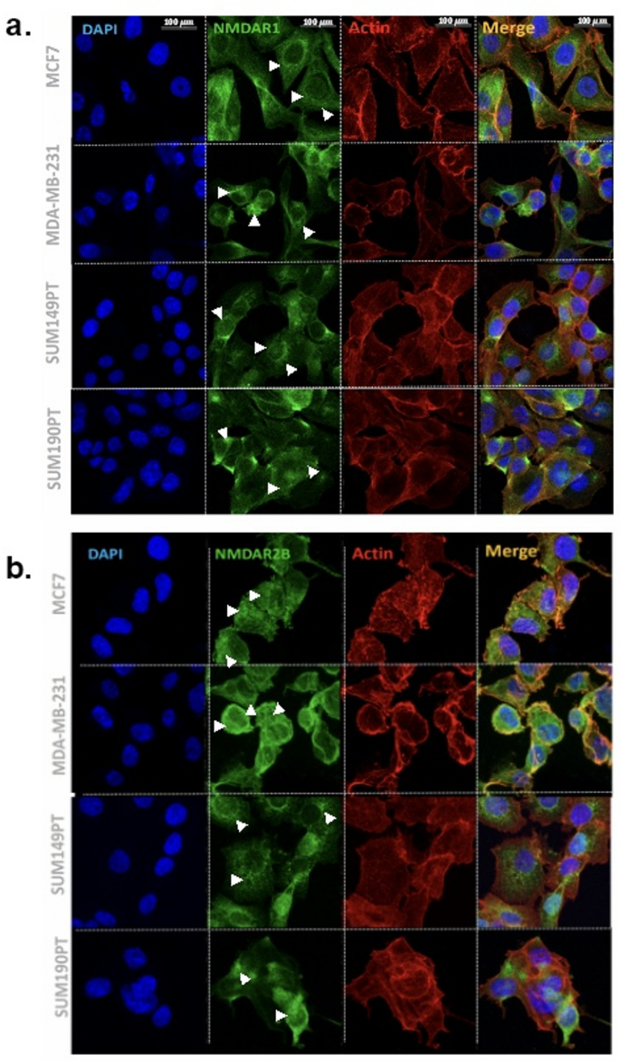 Pharmacological inhibition of NMDA receptors reduces migration and ...