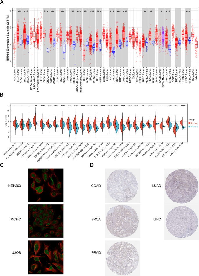 Comprehensive pan-cancer evaluation of NUP85 prognosis, immune ...