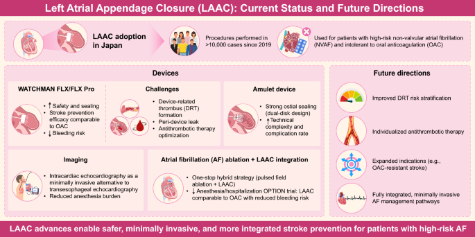 Left atrial appendage closure: Current status, unresolved issues, and ...