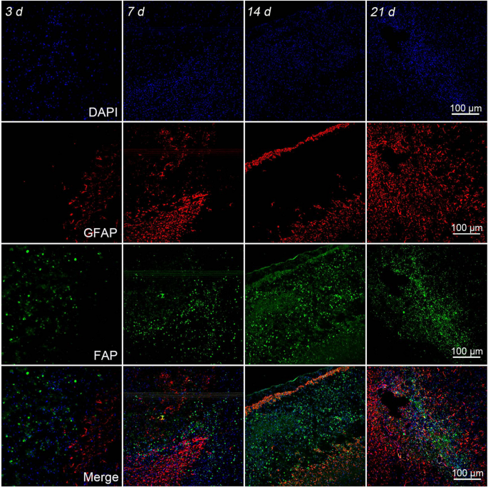 Cerebral [18F]AIF-FAPI-42-Based PET Imaging of Fibroblast Activation Protein for Non-invasive ...