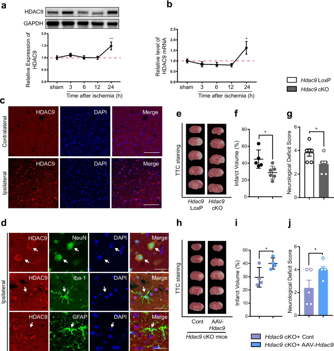 HDAC9 Deficiency Upregulates cGMP-dependent Kinase II to Mitigate ...