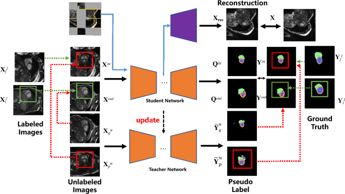 Enhancing semi-supervised medical image segmentation with bidirectional copy-paste and masked ...