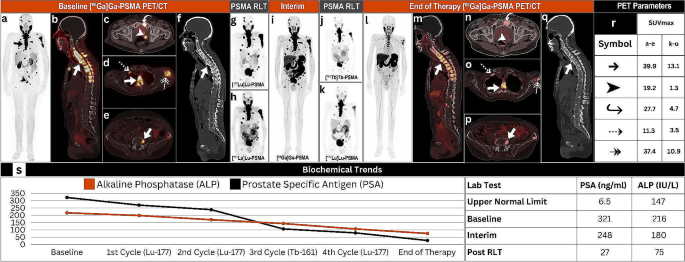 Dual Radionuclide Therapy: The Synergistic Effects of [161Tb]Tb-PSMA ...