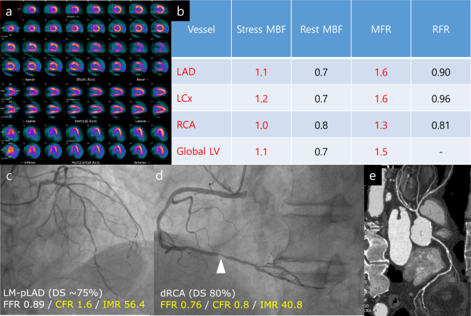 Nuclear Cardiology Post-ISCHEMIA | Nuclear Medicine and Molecular ...