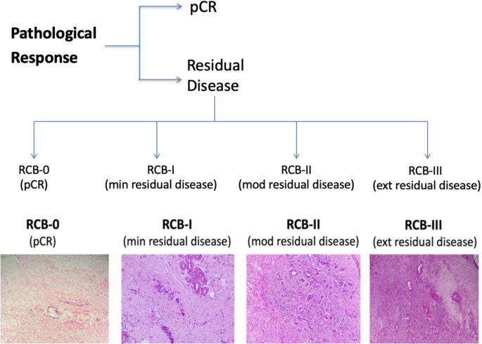 Residual Cancer Burden Index as a Predictor of Recurrence Following ...