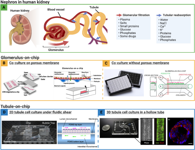 Advancements in Kidney-on-Chip: Antibiotic-Induced Kidney Injury and Future Directions | BioChip ...