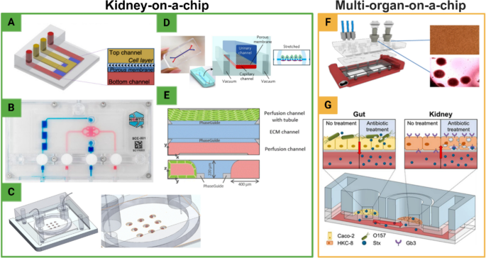 Advancements in Kidney-on-Chip: Antibiotic-Induced Kidney Injury and Future Directions | BioChip ...
