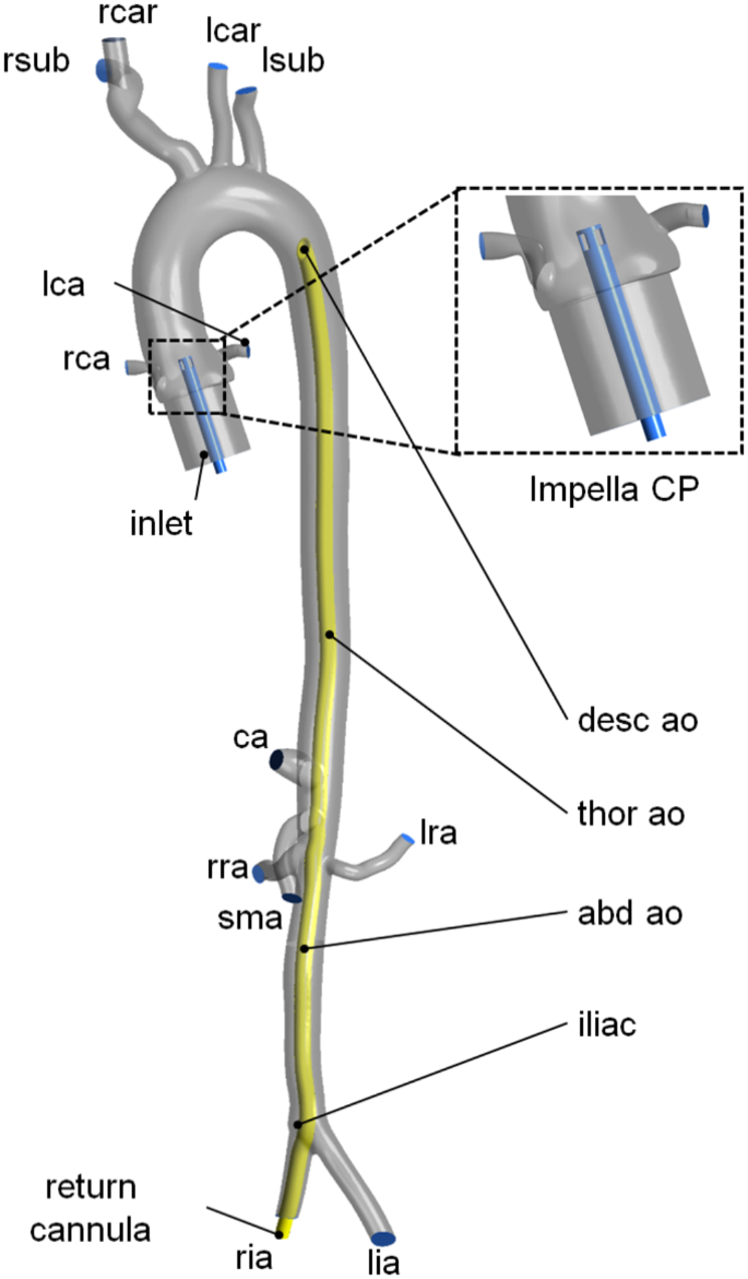 Investigations of Differential Hypoxemia During Venoarterial Membrane ...