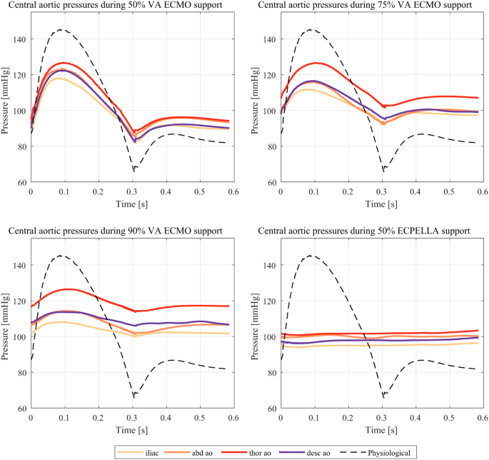 Investigations of Differential Hypoxemia During Venoarterial Membrane ...